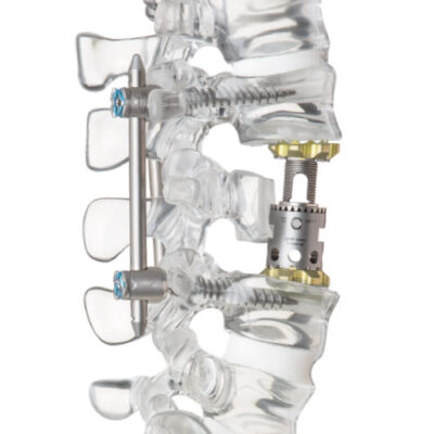 Obelisc Pro – TSI